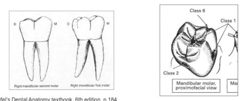 Buccal Pit Prep Flashcards Quizlet