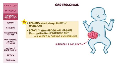 Gastrointestinal Diseases