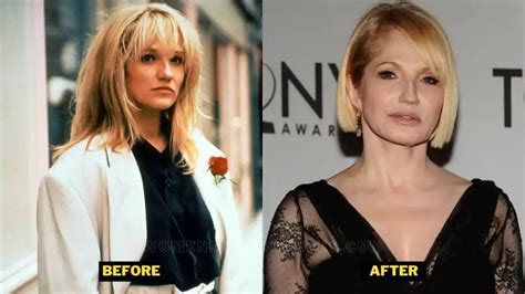 Ellen Barkin Plastic Surgery Appendix Hospitalized And Her Before