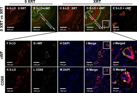 Chronic Vascular Inflammation And Adventitial Vasa Vasorum Expansion In