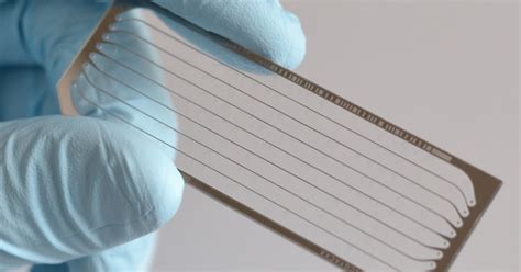 Next Generation Sequencing Ngs In Clinical Microbiology