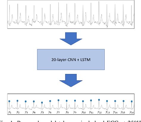 figure 1 from beatwise ecg classification for the detection of atrial