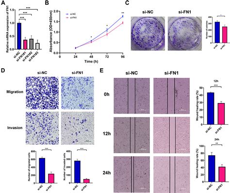 Overexpression Of Fibronectin 1 Promotes Cancer Progression Ijgm
