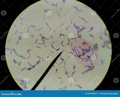 Bacteria Cells Finding With Microscope Stock Image Image Of Healthcare Medicine 107153071