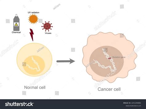 Picture Shows Risk Factor Uv Radiation Stock Vector Royalty Free 2251294881 Shutterstock
