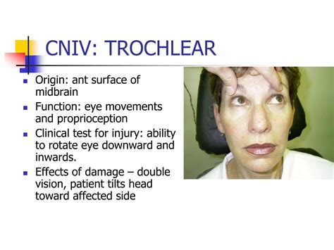 Cranial Nerve Examination Pptx Cranial Nerve Examination Pptx