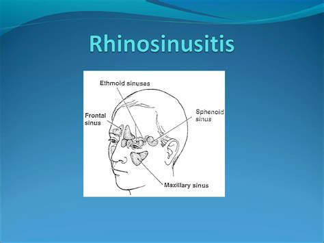 Rhinosinusitis Ppt