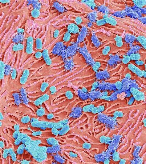 Oral Bacteria Sem Stock Image F013 0054 Science Photo Library