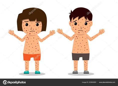 Los Niños Tienen Infografía Varicela Fiebre Los Niños Del Cartel Vector