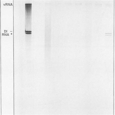 Replication Of Di Particle Rna In Cells Expressing Vsv Proteins Hep 2