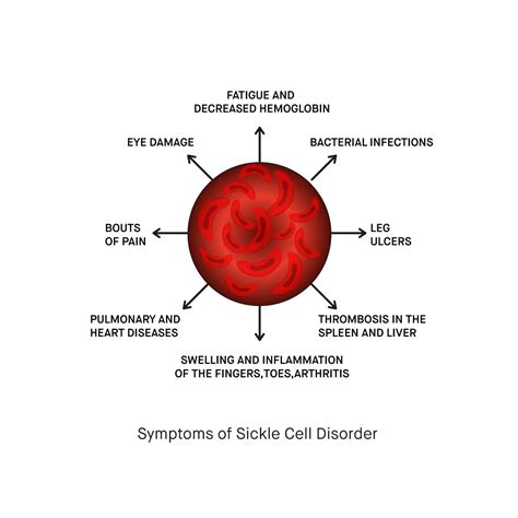 Sickle Cell Symptoms And Complications