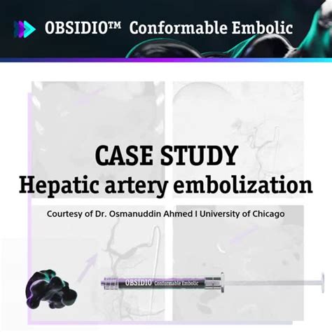 Boston Scientific Peripheral Interventions On Linkedin Obsidio