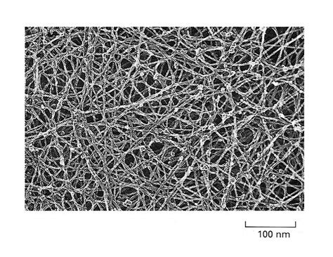 Cytoskeleton Electron Micrograph