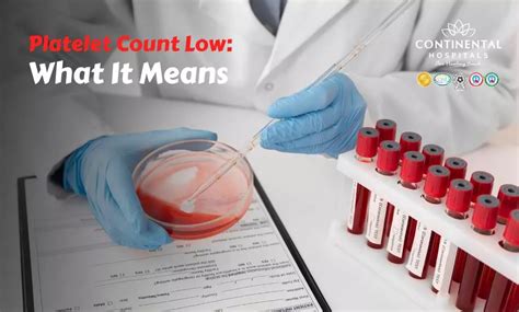Platelet Count Low What It Means