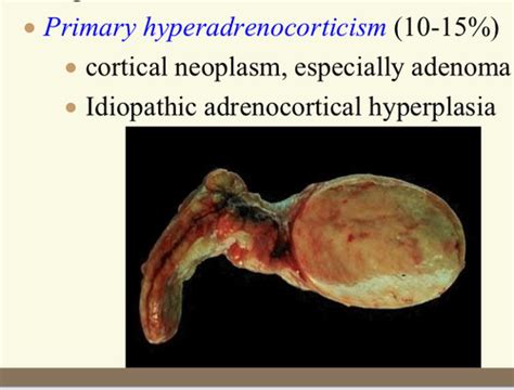 Pathology Ii Endocrine — Adrenal Glands Flashcards Quizlet