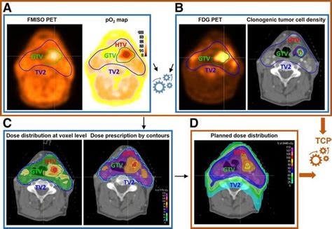 Biologically Individualized Radiotherapy Based On Synergistic Use Of