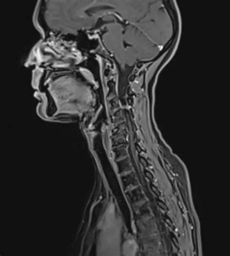 Mrt Kopf Ablauf Vorbereitung Kosten
