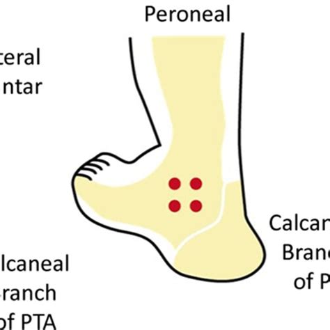 Six Angiosomes Of The Foot Supplied By The Ata Pta And Pa Are