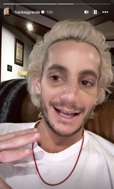 Frankie Grande Revealed His New Nose Job And Ariana Grande Hopped Into