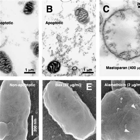 Apoptotic Mitochondria Exhibit Normal Size And Morphology On Electron Download Scientific