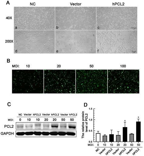 A Overexpression Of Pcl2 With Recombinant Adenovirus In U87 Cells The