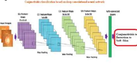 Figure 1 From Detection Of Conjunctivitis With Deep Learning Algorithm In Medical Image