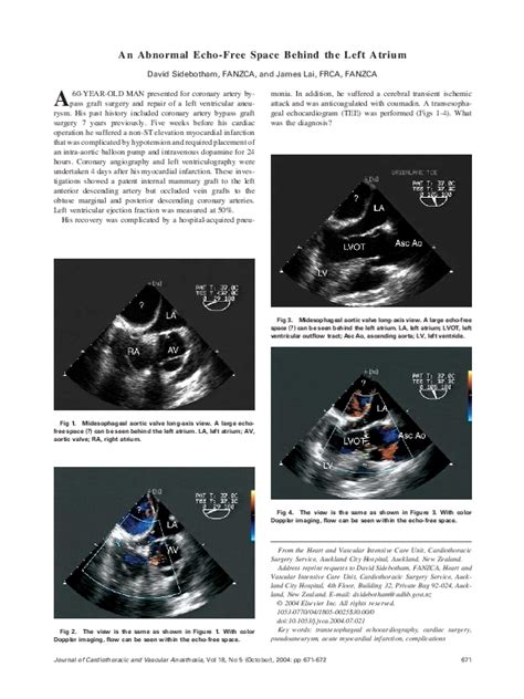 Pdf An Abnormal Echo Free Space Behind The Left Atrium