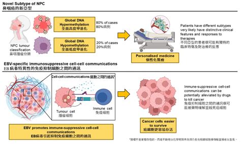 Nasopharyngeal Carcinoma Ebv