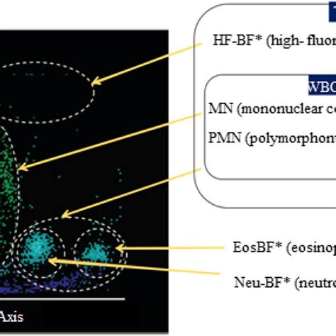 Characteristic Tridimensional Scattergram For Differentiating Diff