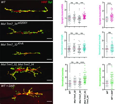 Ftsj1 Dependent Nm Regulates Axonal Morphology In The Drosophila