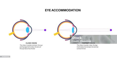 Eye Accommodation Poster Stock Illustration Download Image Now