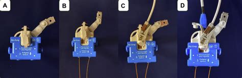 First In Human Use Of A Continuous Real Time Atrial Electrogram Monitoring Device After Cardiac