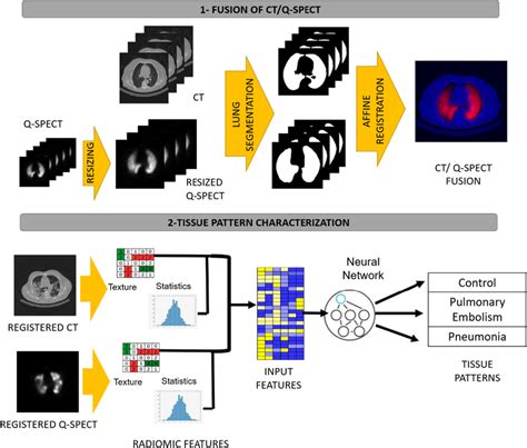 Illustrative Flowchart Of The Stages Of The System Pipeline Download