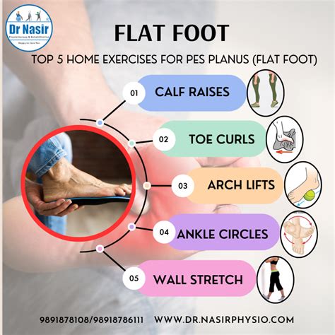 Flat Feet Treatment In Delhi 9891878108 Dr Nasir Physiotherapy