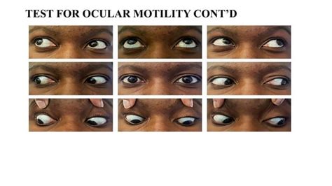 Ocular Motility Ocular Movement Of The Eye Pptx