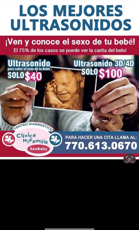 LOS MEJORES ULTRASONIDOS iVen y conoce el sexo de tu bebé El de los casos se puede ver la