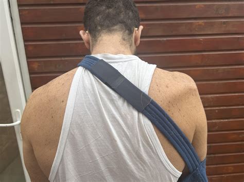 39 Best R Rotatorcuff Images On Pholder 8 And 20 Weeks Post Op Update