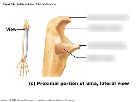 Diagram Of Ulna Lateral View Quizlet