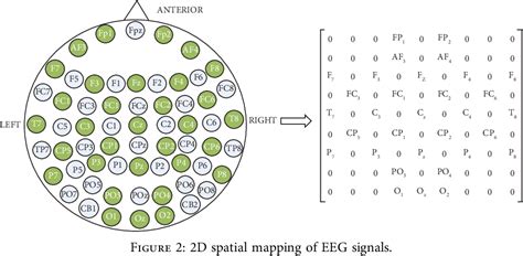 Figure 2 From Eeg Emotion Recognition Based On Temporal And Spatial