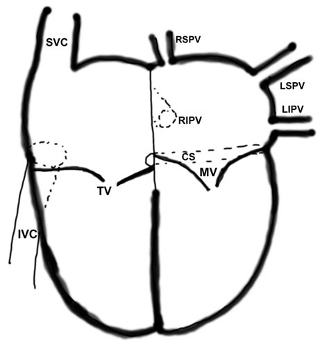 Conduction System Basics And Sinus Rhythm
