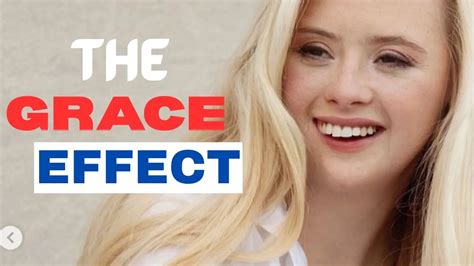 The Inspiring Journey Of Grace Strobel Americas First Down Syndrome