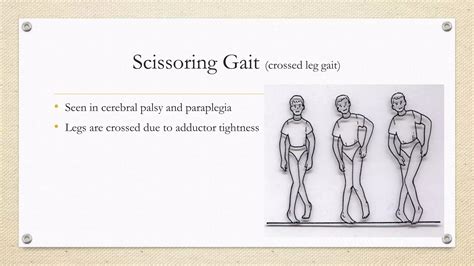 Walking Gait Abnormalitiespptx