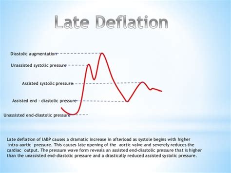 Intra Aortic Balloon Pump Waveform