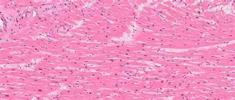 Heart Normal Histology Nus Pathweb Nus Pathweb