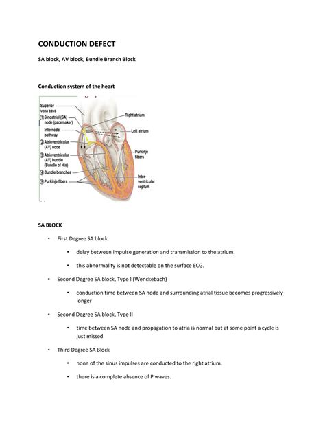 Conduction Defect Summary Ecgs Made Easy Ecgs Made Easy