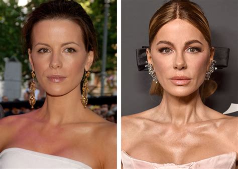 Celebrities With Most Plastic Surgery 60 Photos Moonagedaydreamfilm