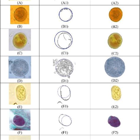 Microscopic Image Of Stool This Image Contains A Tapeworm Egg An Egg