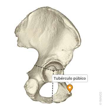 Tubérculo Púbico E Anatomy Imaios