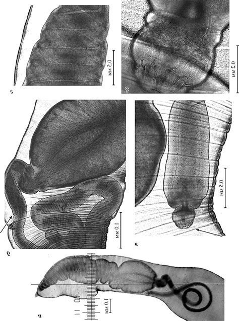 Late Scolexogenesis In D Asper Megalocercus Download Scientific Diagram