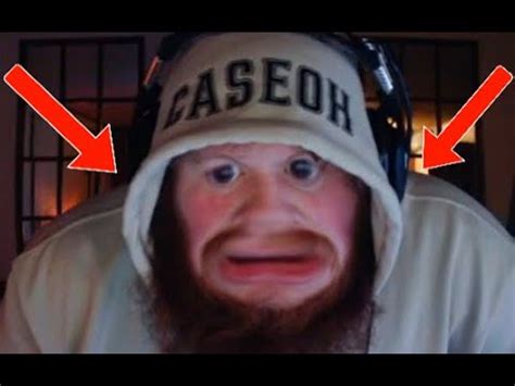 Caseohs Funniest Moments Compilation 😂🔥 Best Twitch Clips